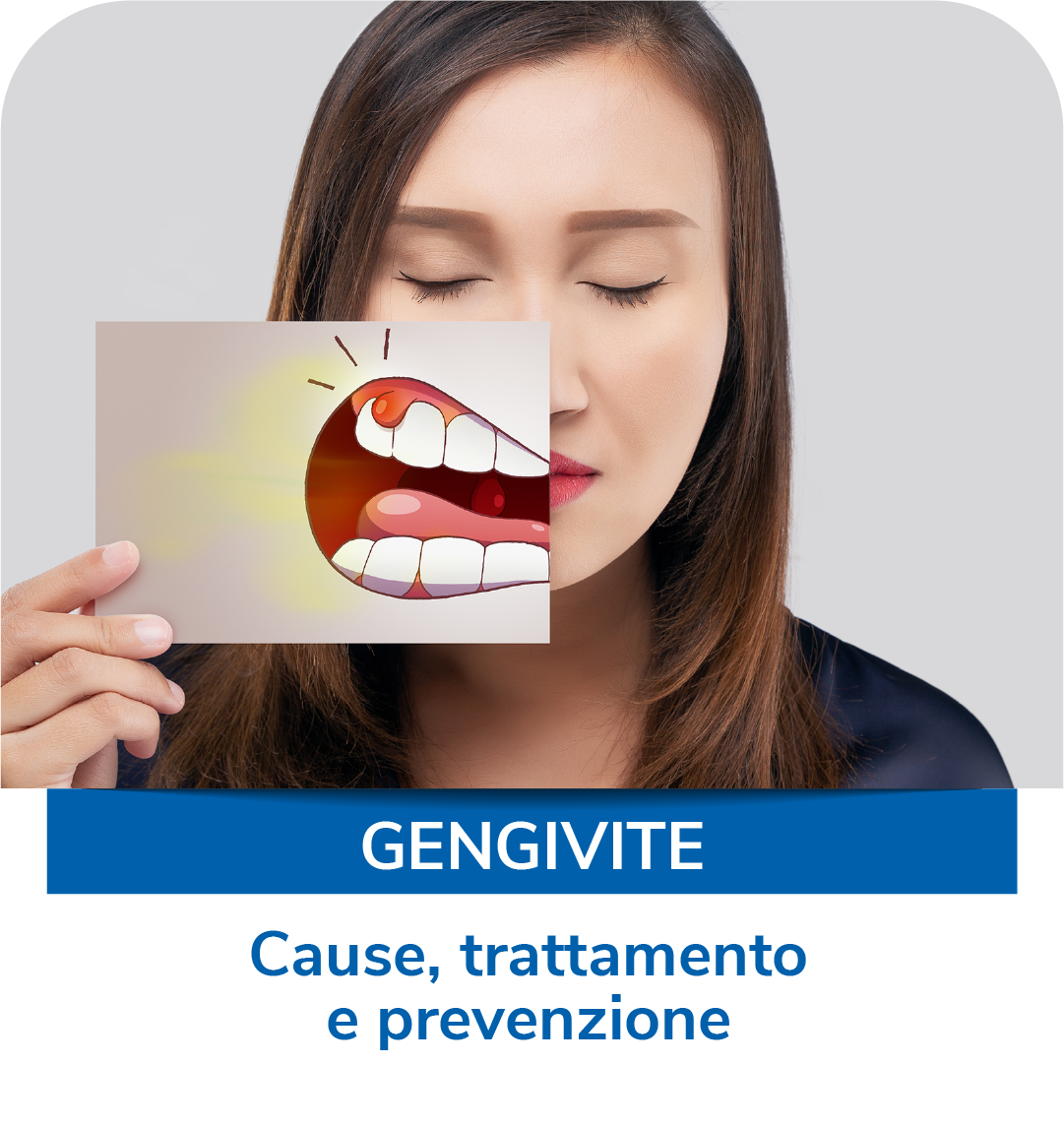 La gengivite Cause, Trattamento e Prevenzione | Dentosan