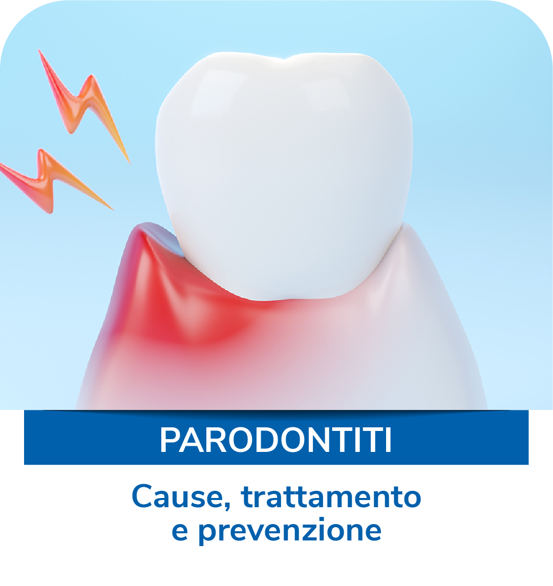 Paradontite - Cause, Sintomi e Cura | Dentosan